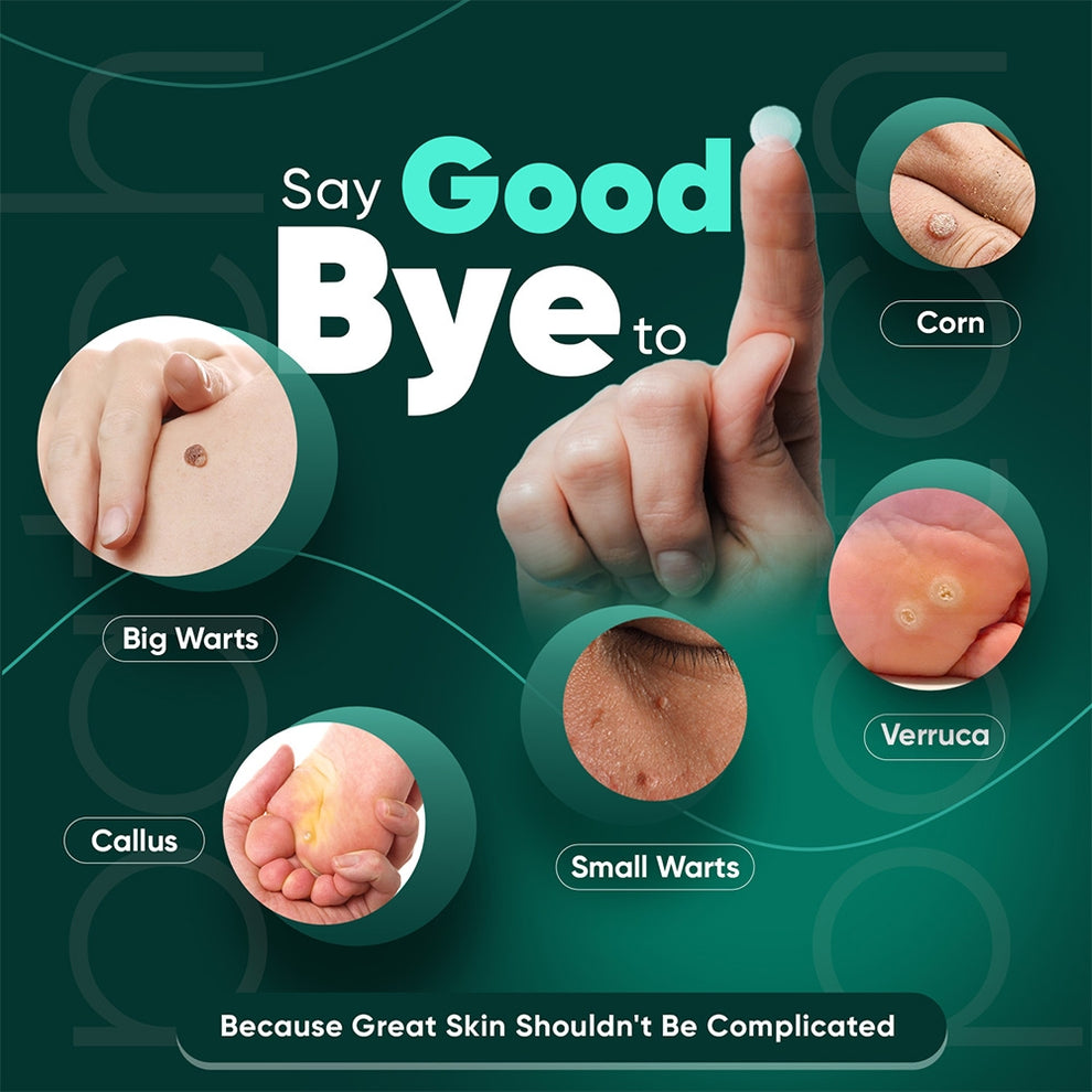 Wart, Corn & Verruca Plasters | 28 Waterproof Patches | WeightWorld